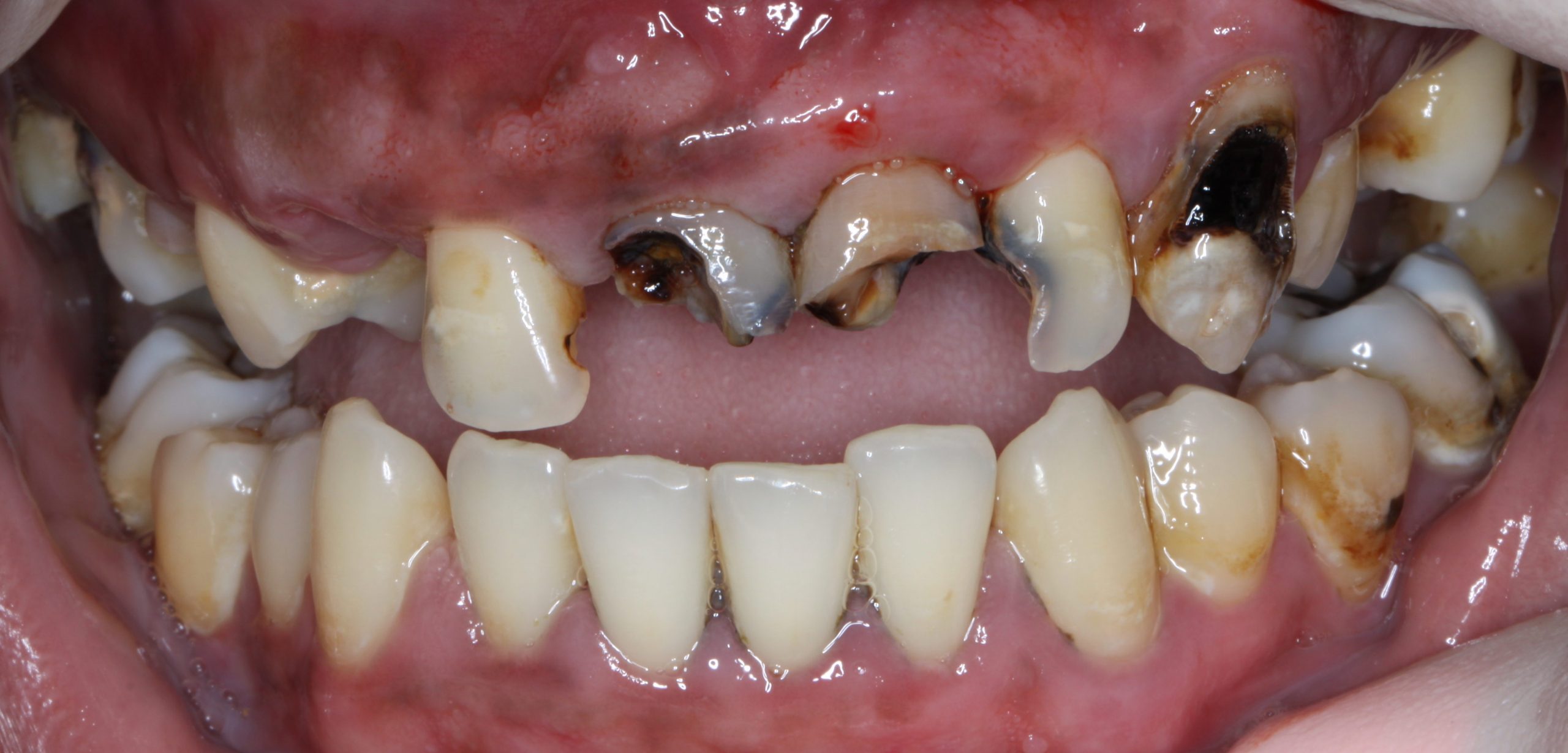 What is the Fiji Dental & Medical Foundation? | Namotu Island Fiji