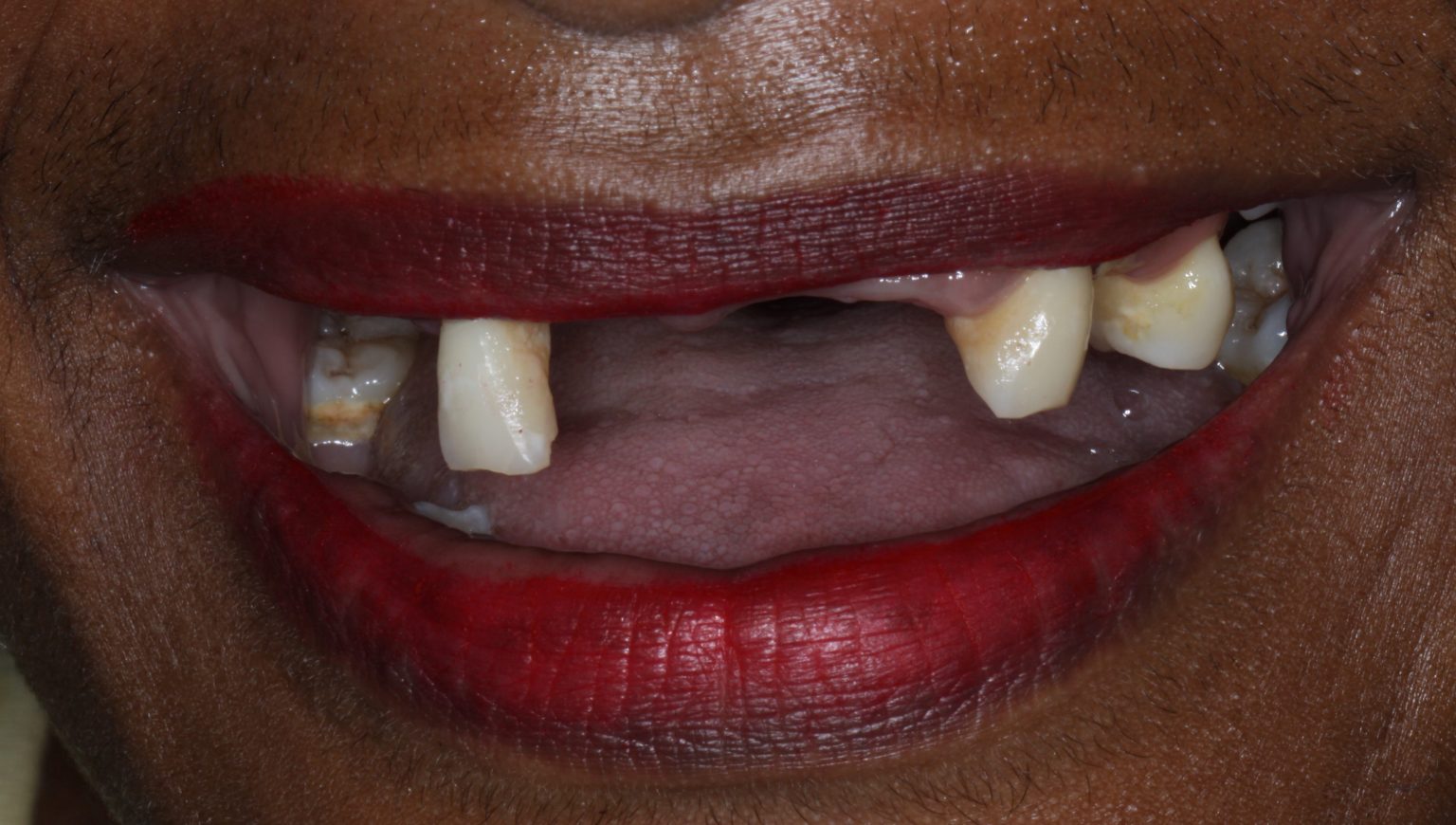 What is the Fiji Dental & Medical Foundation? | Namotu Island Fiji